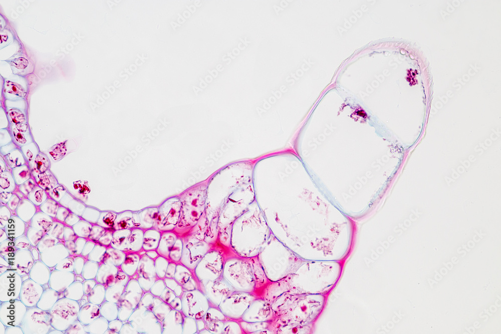 Cross-section Plant Stem under the microscope for classroom education ...