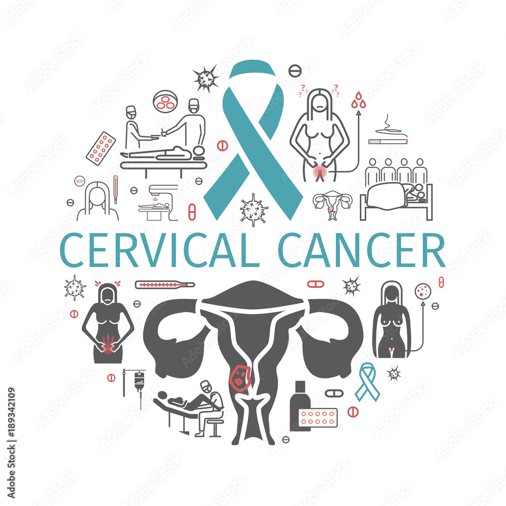 Cervical Cancer Banner . Symptoms, Causes, Treatment. Line icons set ...