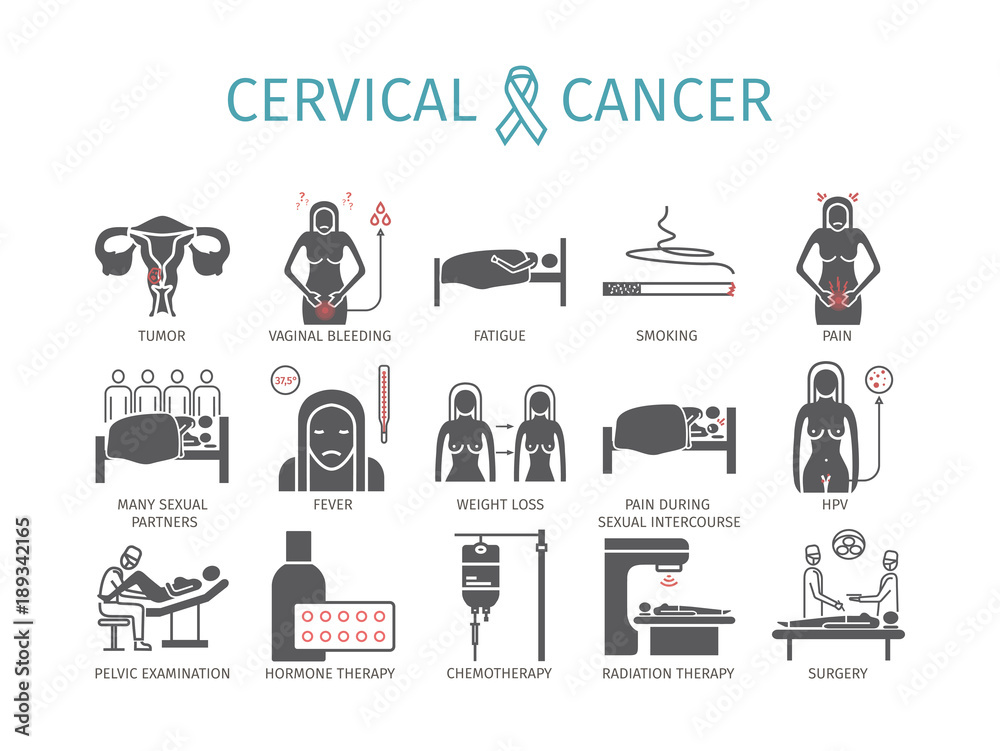 Cervical Cancer. Symptoms, Causes, Treatment. Icons set. Vector signs ...
