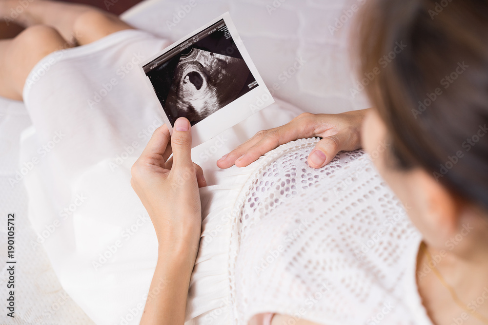 Pregnant asian woman looking at ultrasound scan of baby and touching ...