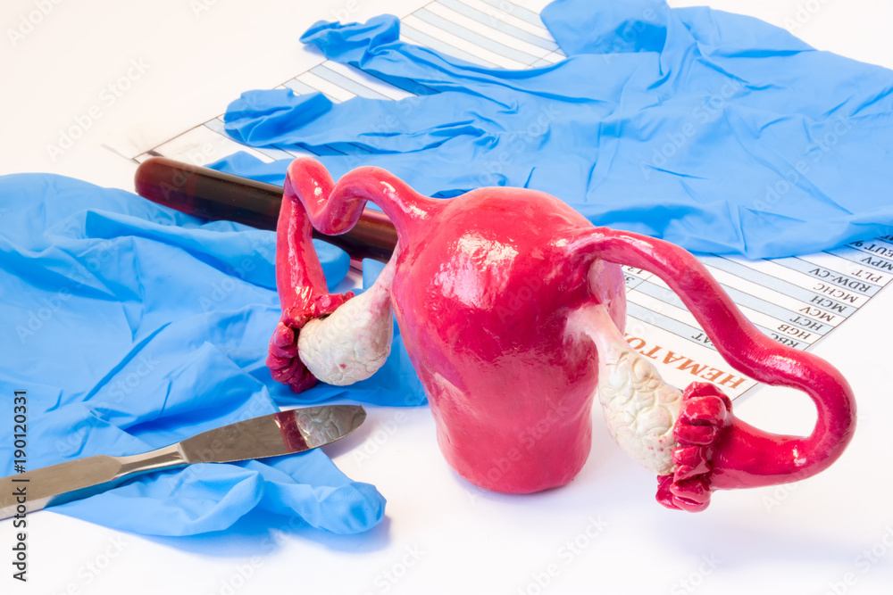 Obraz w ramie Uterus and ovaries genital female surgery concept. Model ...