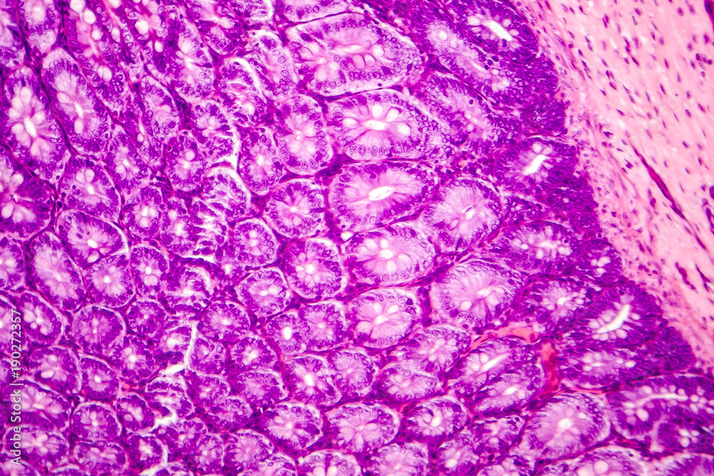 Histology of human appendix, micrograph showing Crypts of Lieberkuhn ...