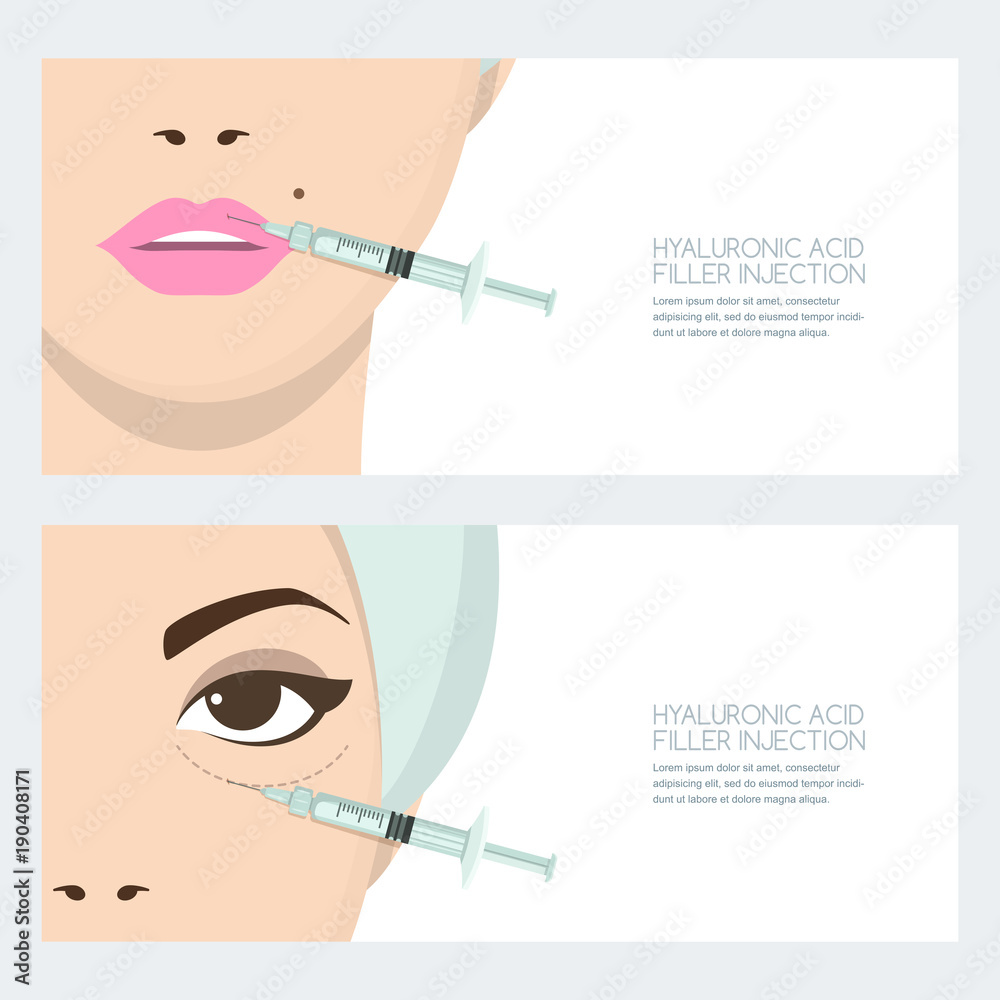 Hyaluronic acid facial injection, vector banner design template. Lips ...