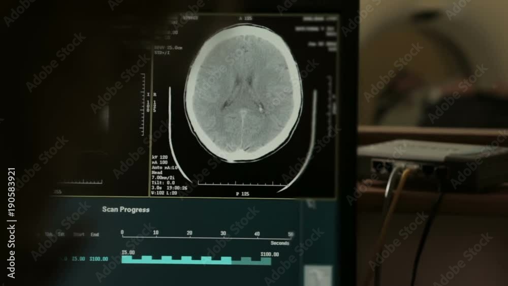 Tumor x-ray results on screen with MRI machine behind, computer ...