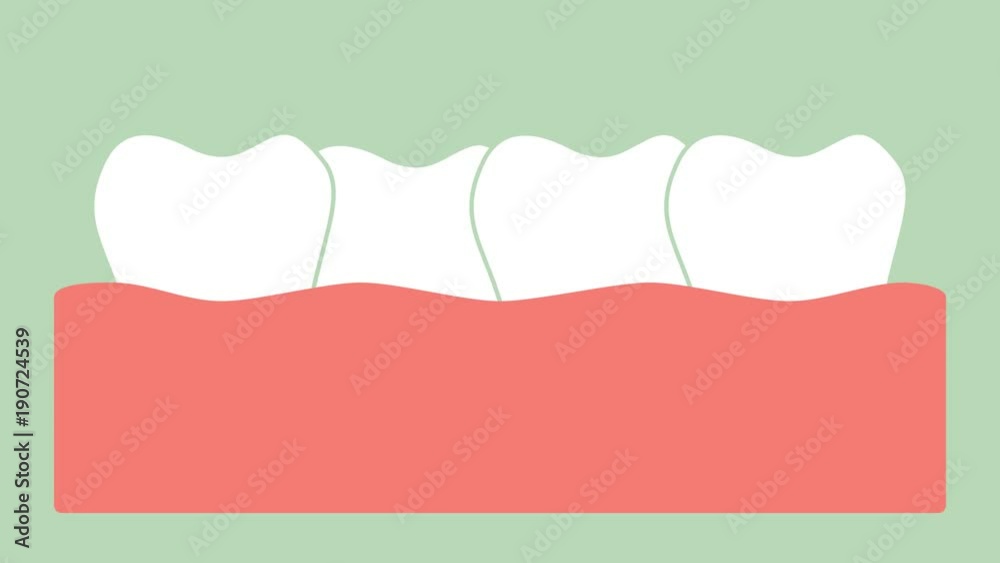 crowding teeth ( malocclusion ) - dental cartoon vector flat render 2d ...