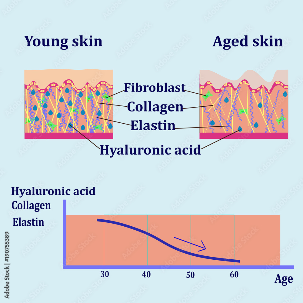 Vector diagram with schemes of two types of skin, for cosmetological ...