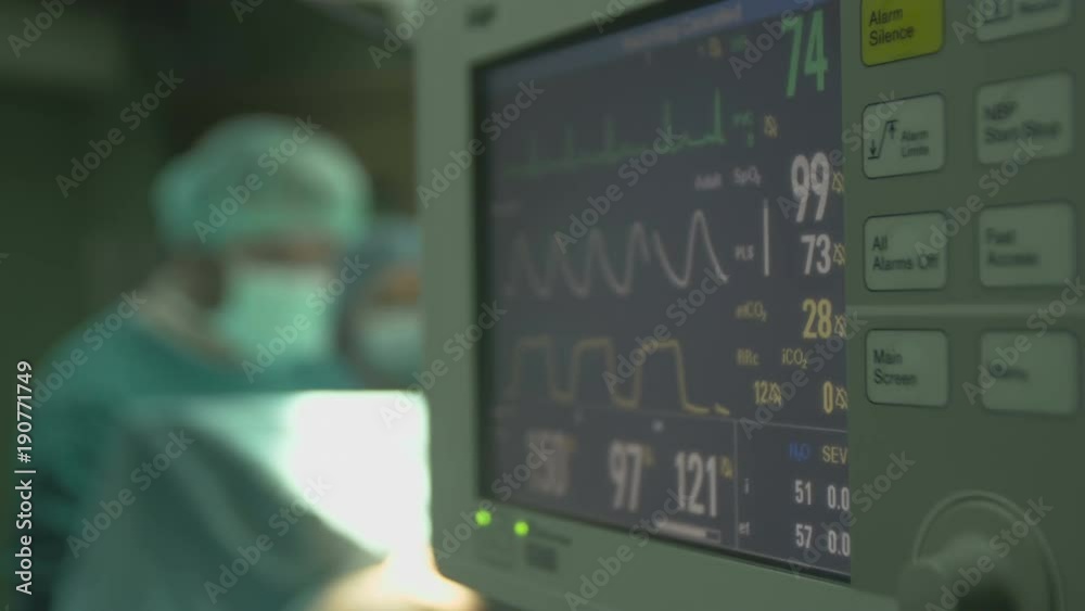 Vidéo Stock Electrocardiograph machine display,graphics of electrical ...