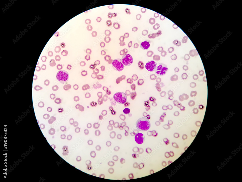 Human blood smear under microscope Stock Photo | Adobe Stock