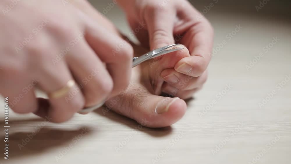 Man cutting toenails with scissors. Male cut toenails on foot. Toenails ...