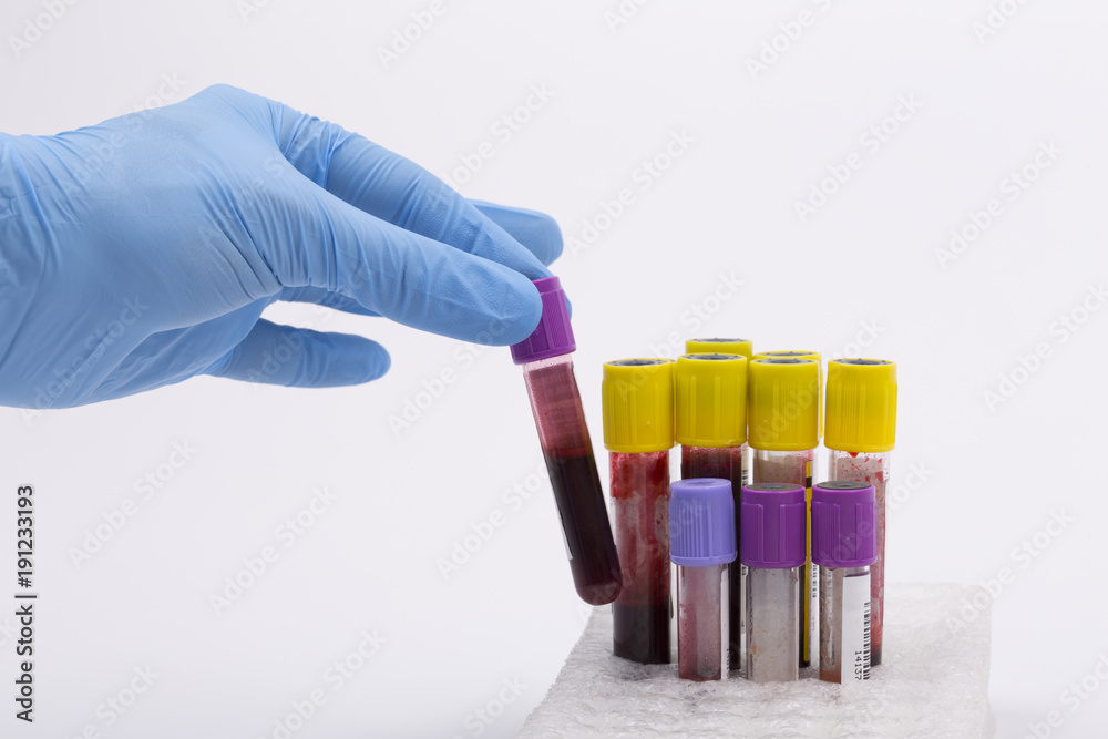 blood test tubes white background Stock Photo | Adobe Stock