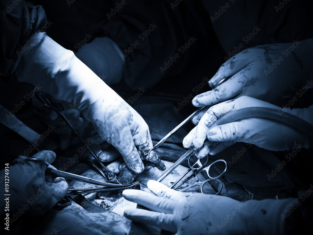 black and white and blue color tone of surgeon and assistant team hands ...