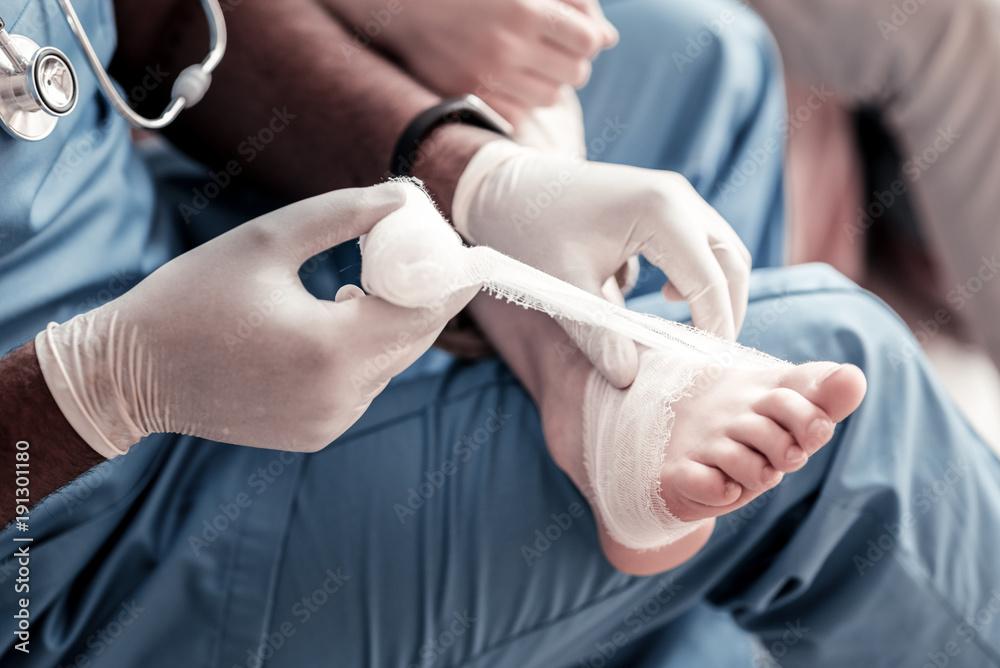 Painful moment. Close up of a male medical worker applying a bandage on ...