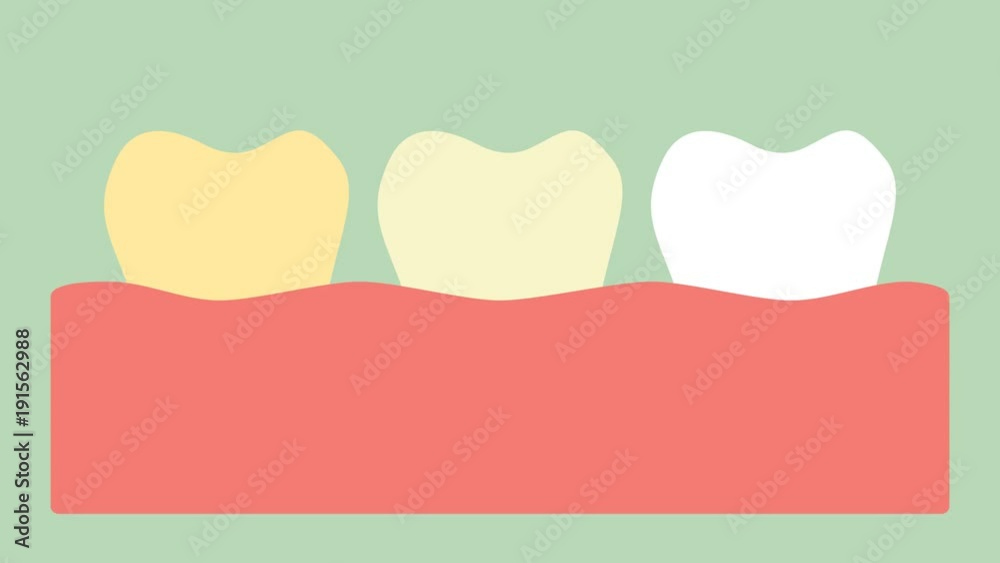 yellow to white tooth, teeth whitening and dental health care concept ...