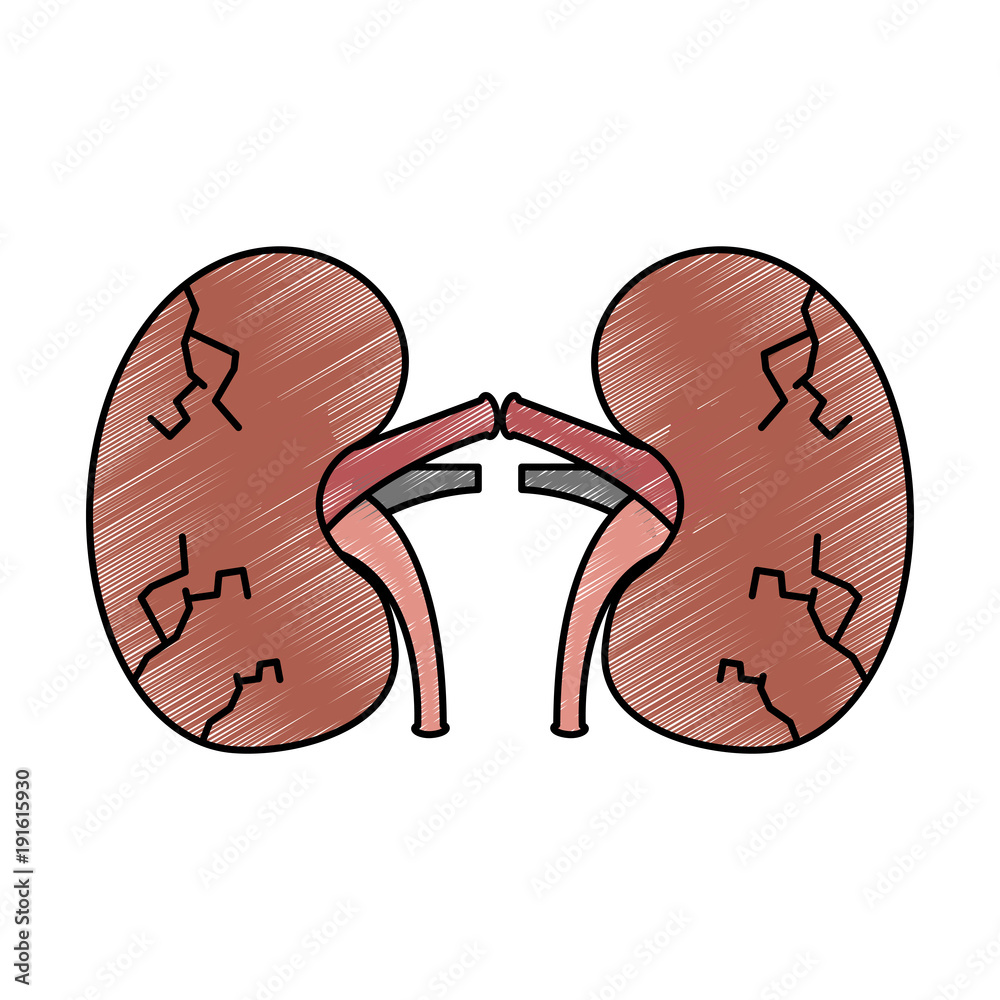 Damaged Kidney