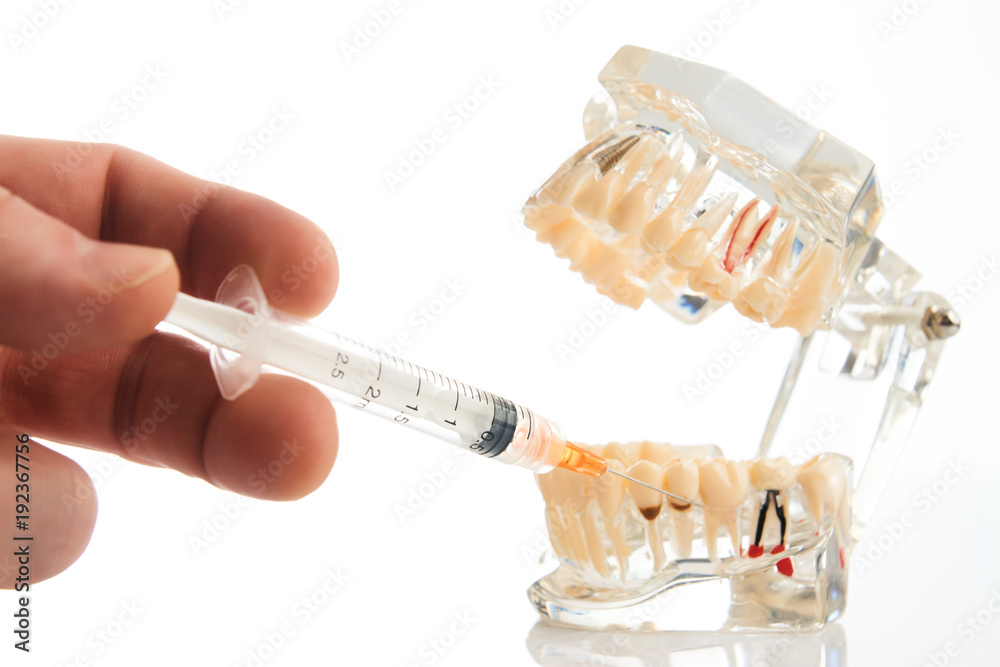 Doctor dentist holding syringe, needle stabs into jaw between the teeth ...