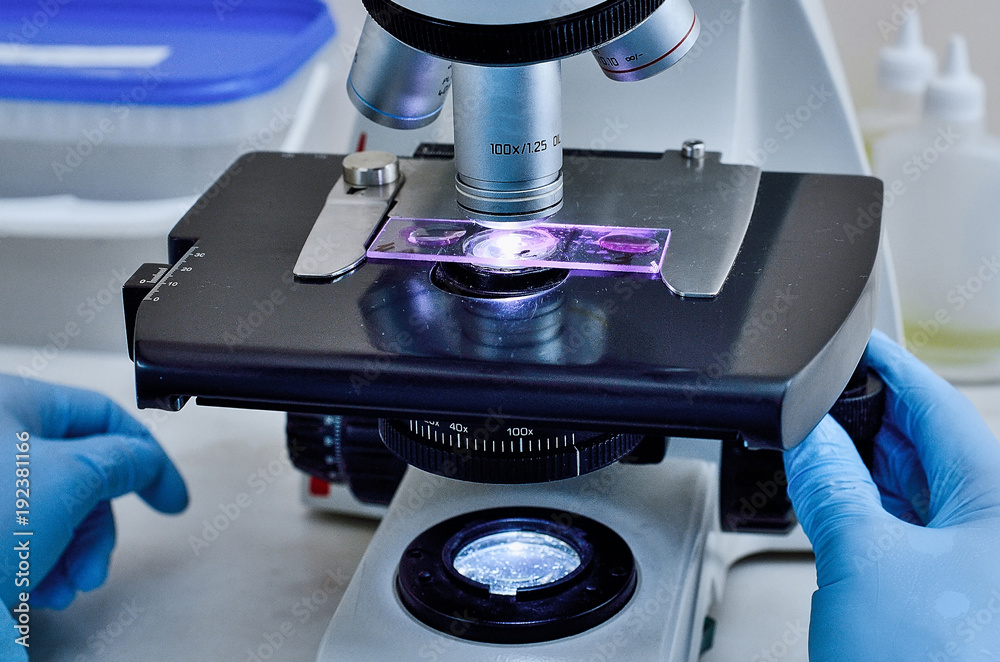 Microscope. Microbiological laboratory. Mold and fungal cultures ...