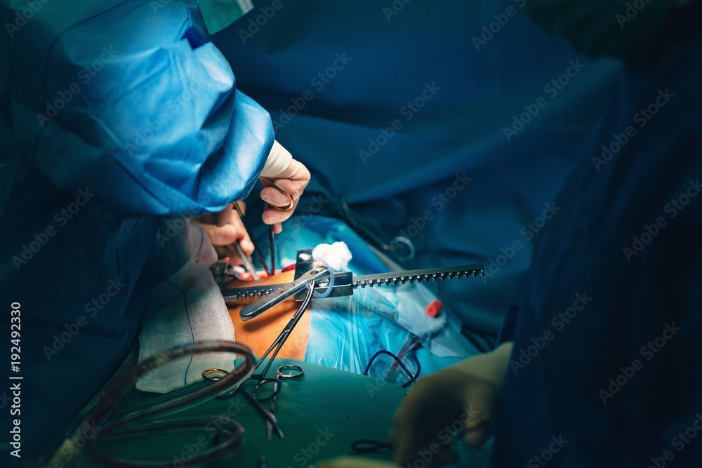 Team of surgeons in hospital operating room. Ready for cardiovascular ...