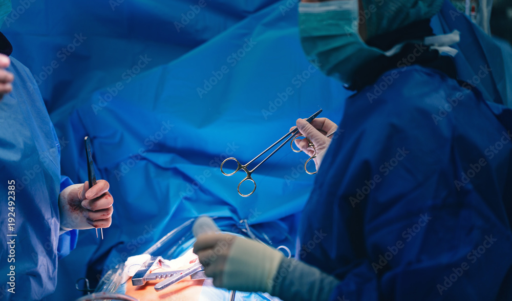 Team of surgeons in operating room. Passing a needle holder or a needle ...