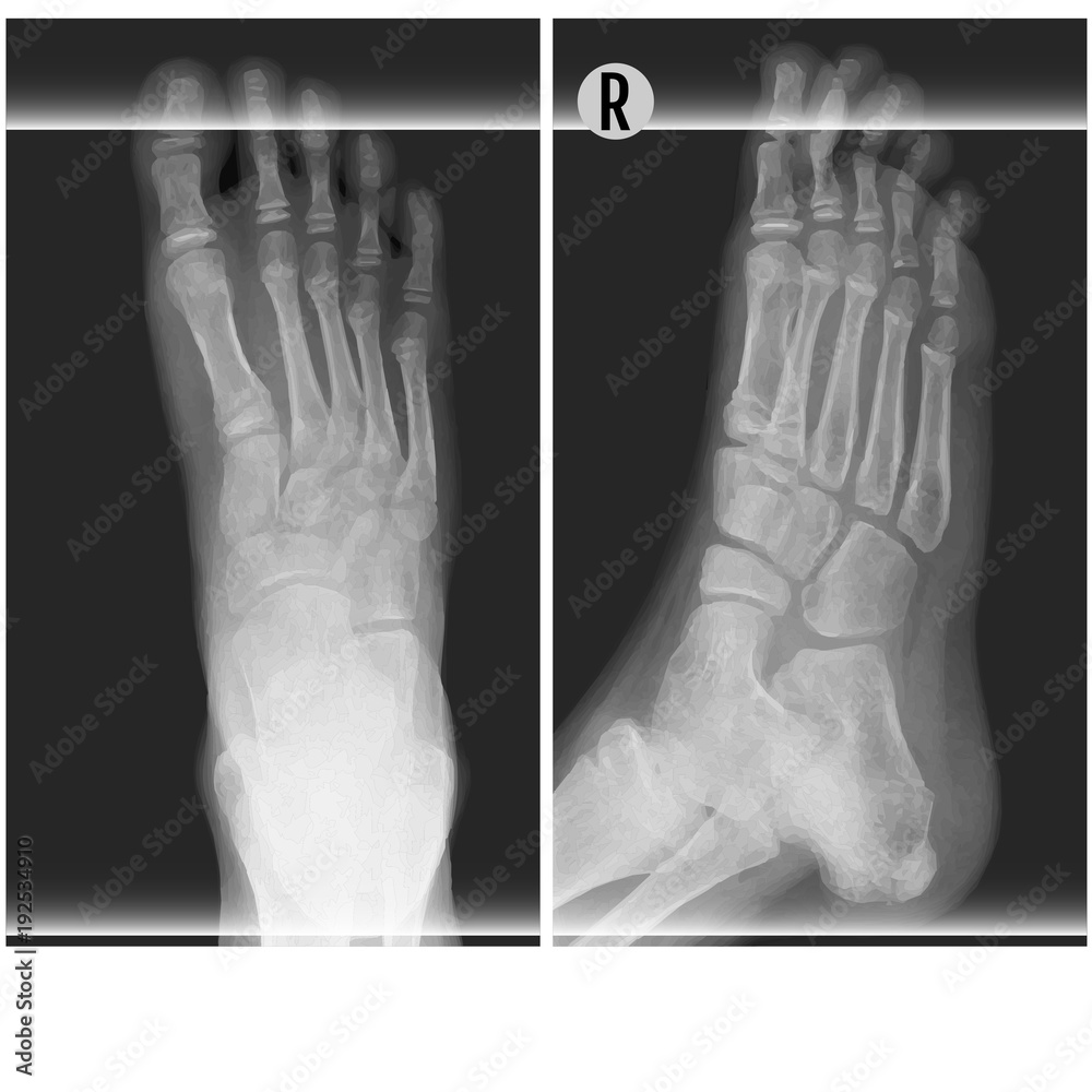 Human foot ankel and leg xray vector illustration. Top and right scan ...