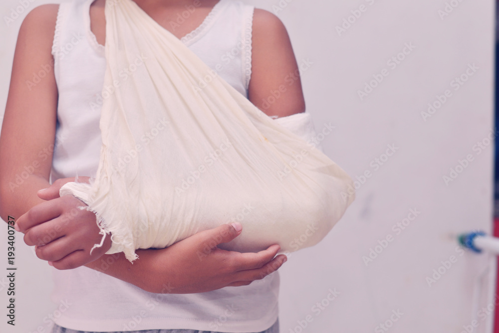 Patients forearm fracture.Paramedical using arm sling to stabilize ...