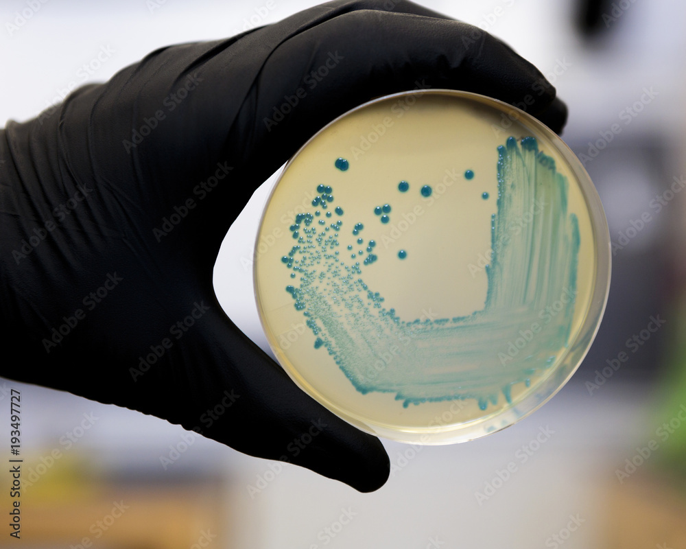 Food safety pathogen Listeria monocytogenes isolated on agar from a ...