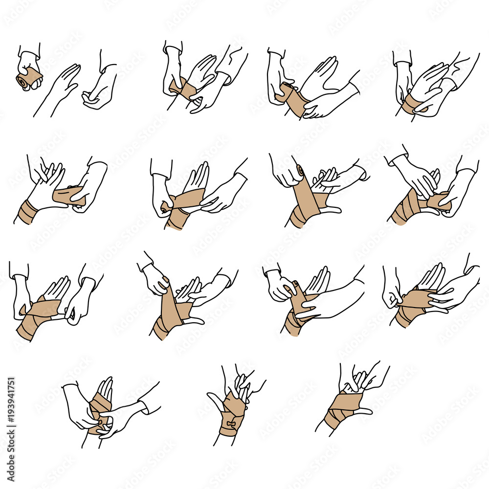 How to wrap a hand with elastic gauze vector illustration sketch hand ...