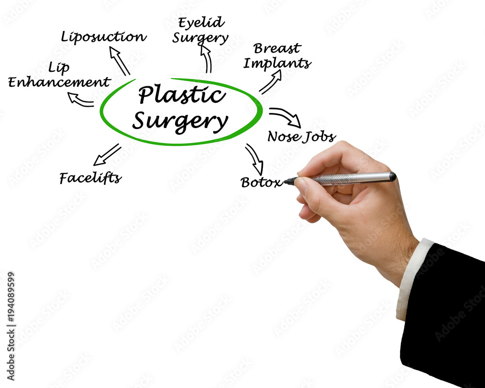 Diagram of Plastic Surgery Stock Photo | Adobe Stock