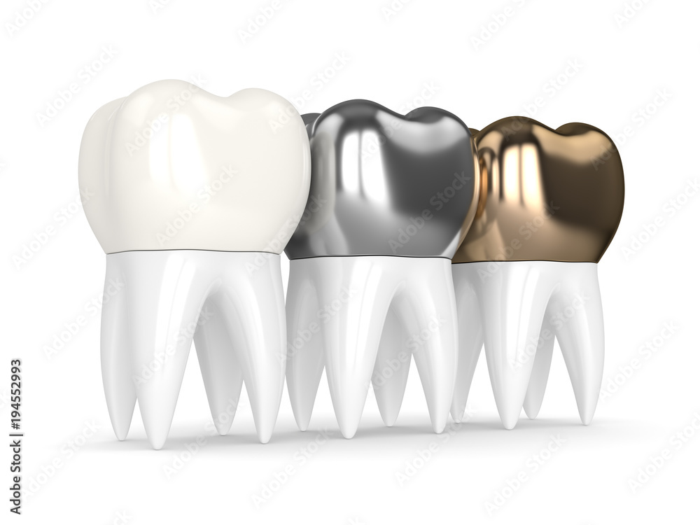 3d render of teeth with different types of dental crown Stock ...