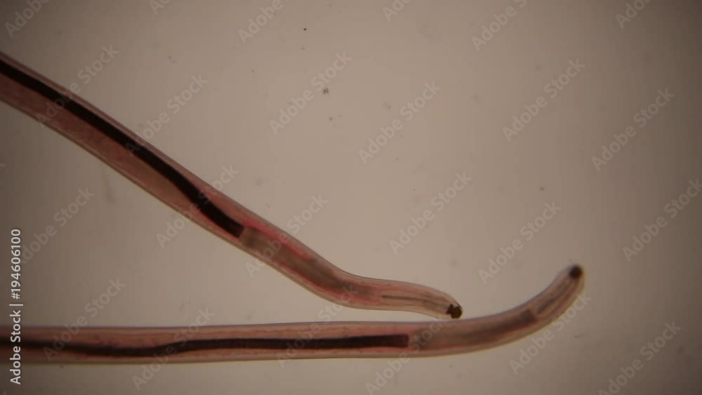 Camallanus is a genus of parasitic roundworms in the family ...