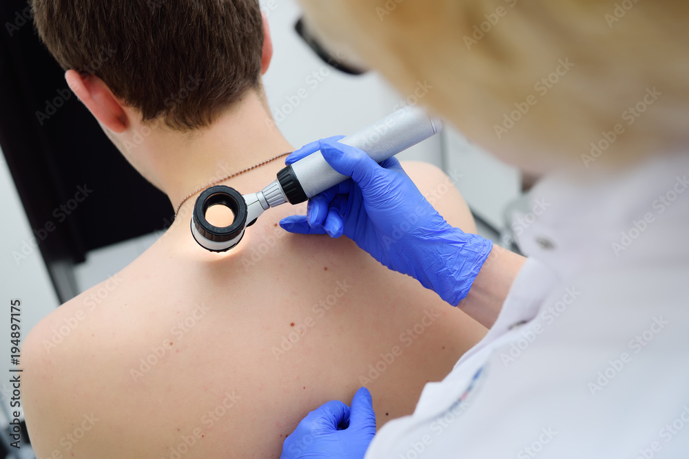 Method of dermatoscopy of skin lesions and moles. Preventing Melanoma ...
