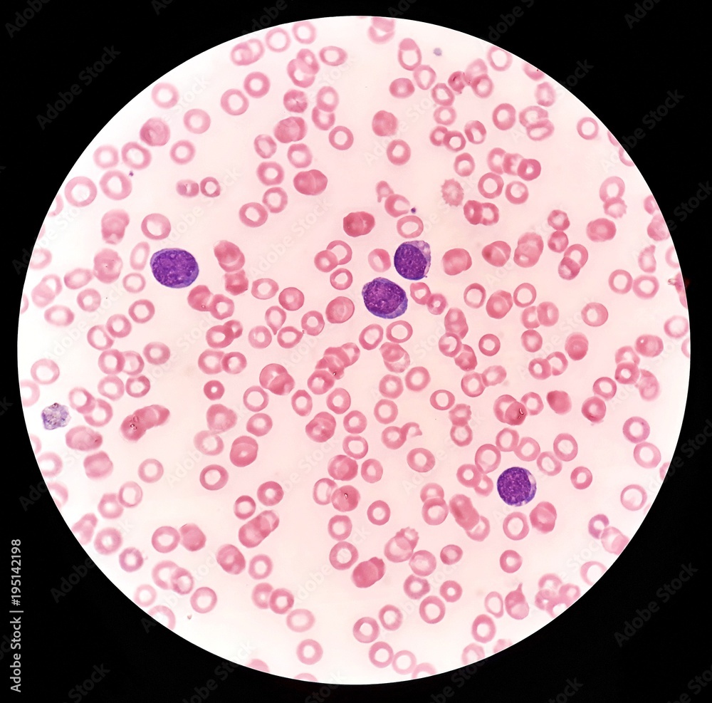 Blood Smear Under Microscope Labeled at Deborah Vann blog Blood Smear Under Microscope Labeled at Deborah Vann blog
