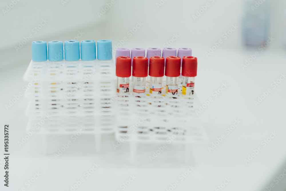 Medical equipment. Close up of some 3 ml test tubes with mauve plugs ...