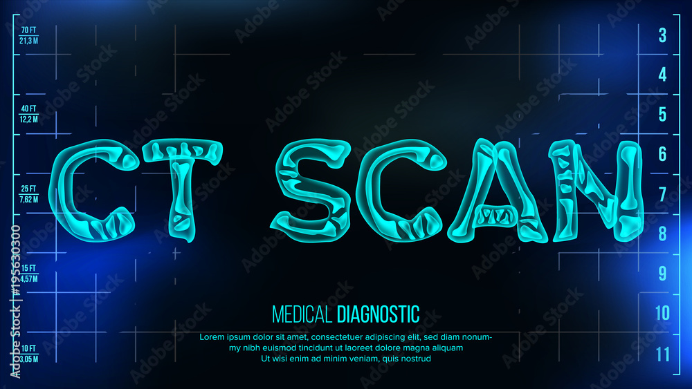 CT Scan Banner Vector. Medical Background. Transparent Roentgen X-Ray ...