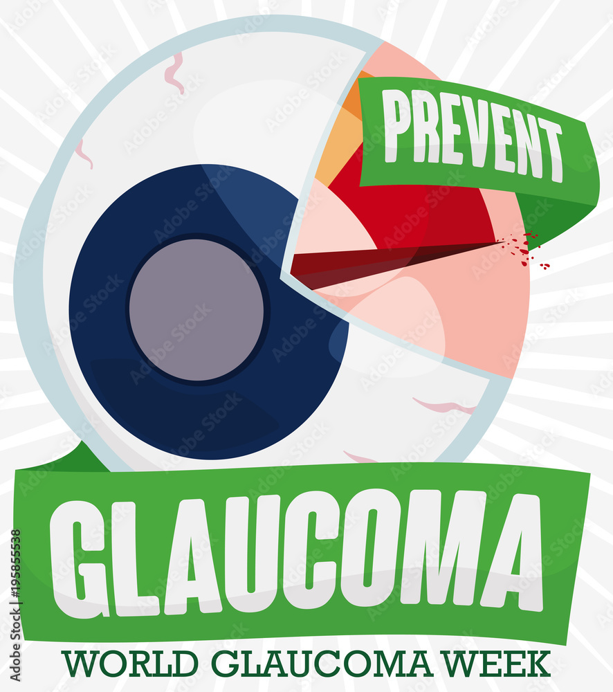 Eye like Manometer with High Pressure Promoting World Glaucoma Week ...
