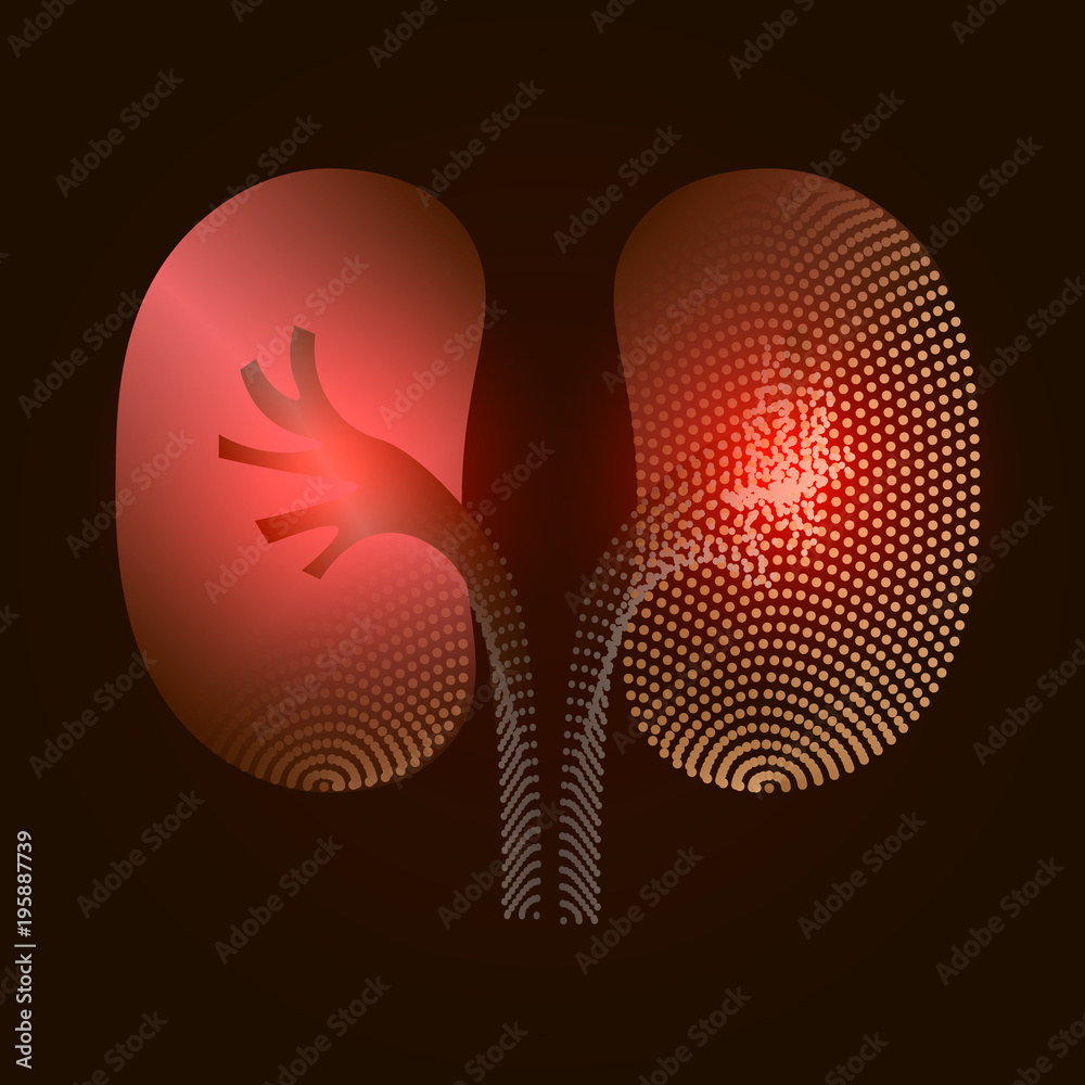 Real Kidneys
