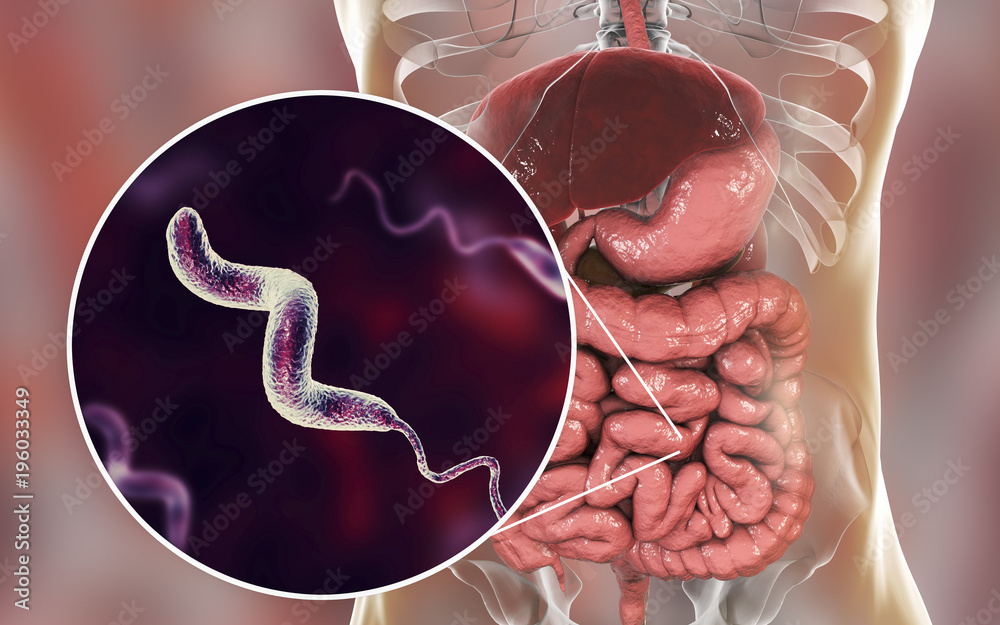 Campylobacter bacteria in intestine, C. jejuni, C. fetus, Gram-negative ...
