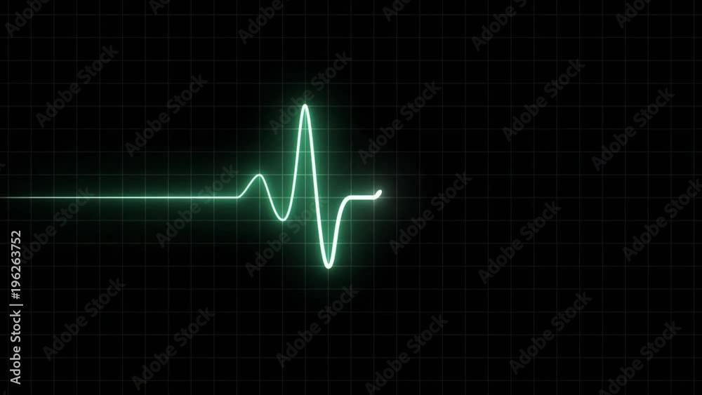 EKG 60 BPM Loop Screen, Green w/ Grid. Heart rate monitor ...