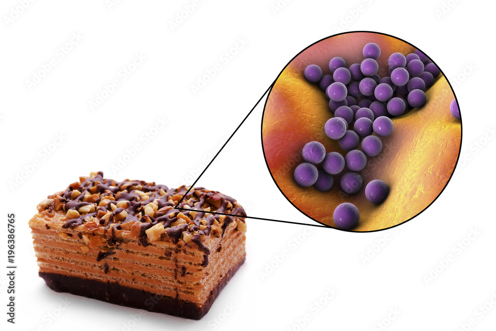 Staphylococcal food poisoning, medical concept, 3D illustration showing cake as a common source ...