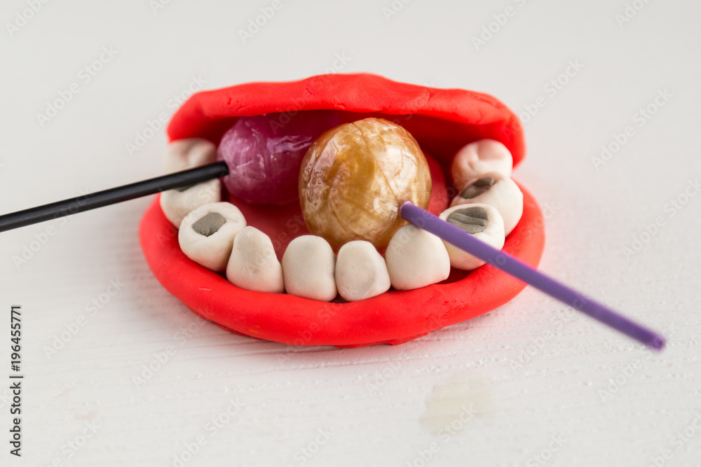 dental care. make teeth with play dough . rotten tooth concept. dentist ...