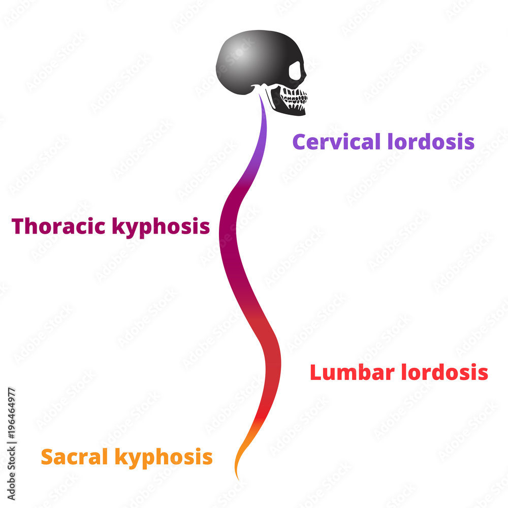 Diseases of the spine. Lordosis, kyphosis. Body posture defect ...