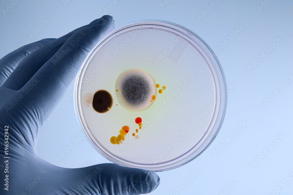 technician hand holding petri dish with microbes culture in the lab ...