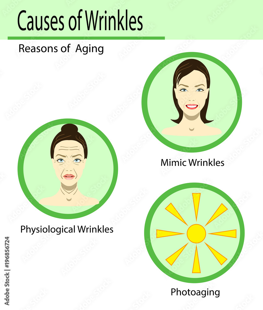 Causes of aging, vector illustration reasons of aging, types of ...