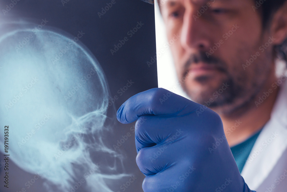 Doctor examining x-ray of the skull Stock Photo | Adobe Stock