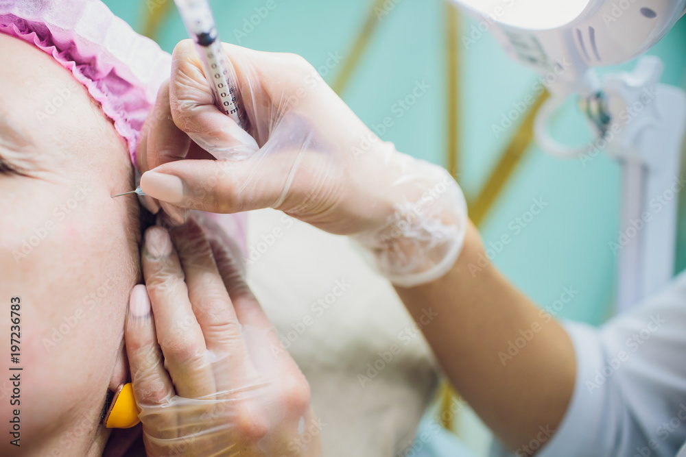 Professional holding the needle cannula on hand for piercing. Closeup ...