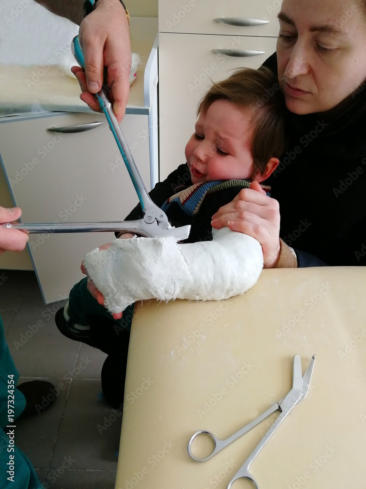 Doctor removing a plaster cast and bandages to patient forearm and ...