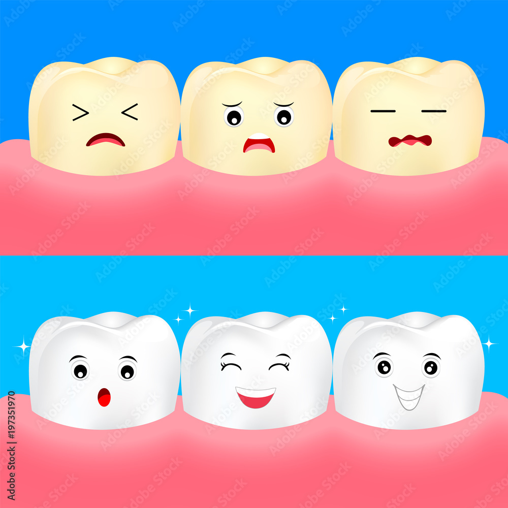Cute cartoon white and yellow teeth. Before and After, whitening oral ...