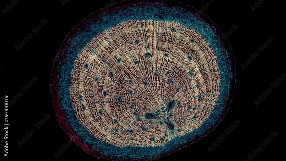 Pinus, pine, older woody root - microscopic cross section cut of a ...