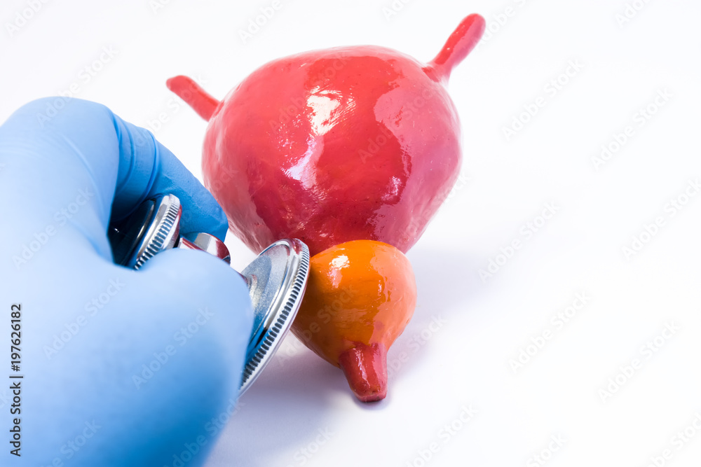 Prostate gland examination or diagnosis process by doctor. Doctor with ...