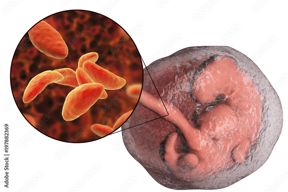 Transplacental transmission of Toxoplasma gondii parasites to human ...