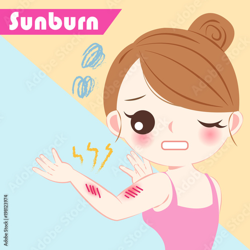 Sunburn Animation